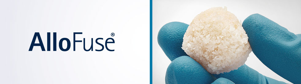 ALLOGRAFT – Life Medical Equipment